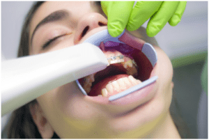 Science Has Found a Way to Regrow Tooth Enamel- Saunders DDS